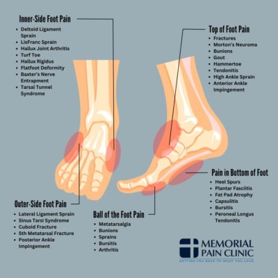 Foot Pain Chart: Common Foot Problems | Memorial Pain Clinic