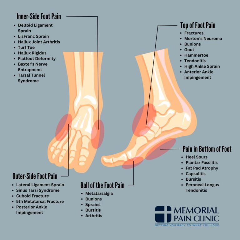 Foot Pain Chart: Common Foot Problems | Memorial Pain Clinic