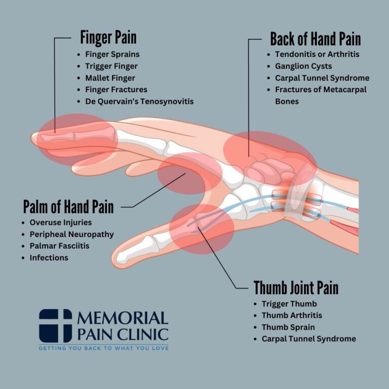 Hand Pain Diagram | Memorial Pain Clinic | Tulsa, OK
