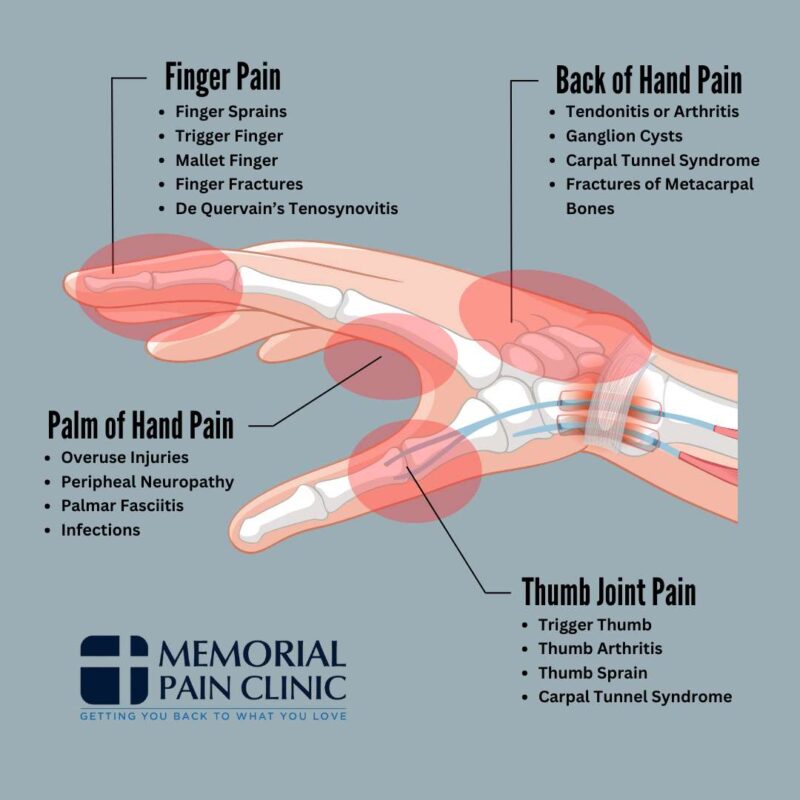 Hand Pain Diagram | Memorial Pain Clinic | Tulsa, OK
