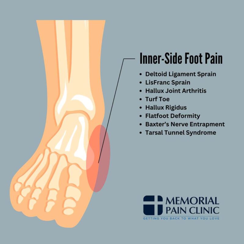 Foot Pain Chart: Common Foot Problems | Memorial Pain Clinic