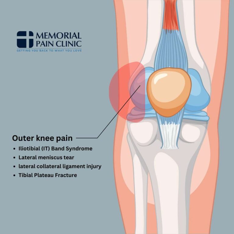 Knee Pain Location Chart | Memorial Pain Clinic | Tulsa, OK