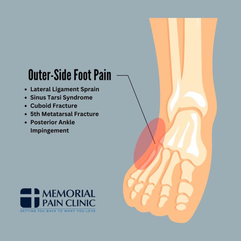 Foot Pain Chart: Common Foot Problems | Memorial Pain Clinic