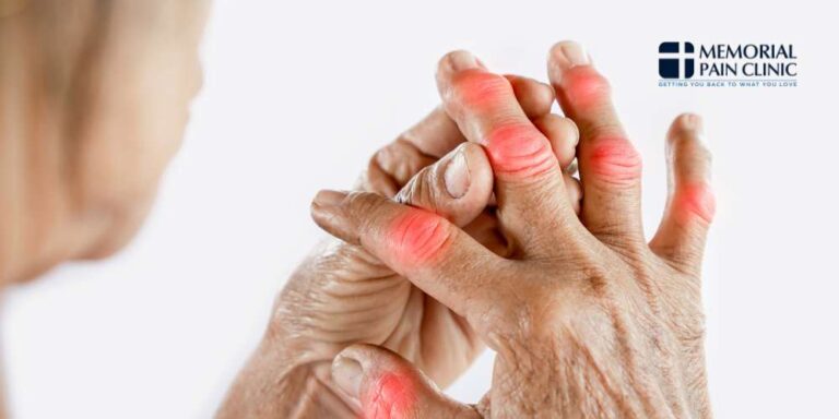 Pain in Hand and Fingers, Not Arthritis | Memorial Pain Clinic